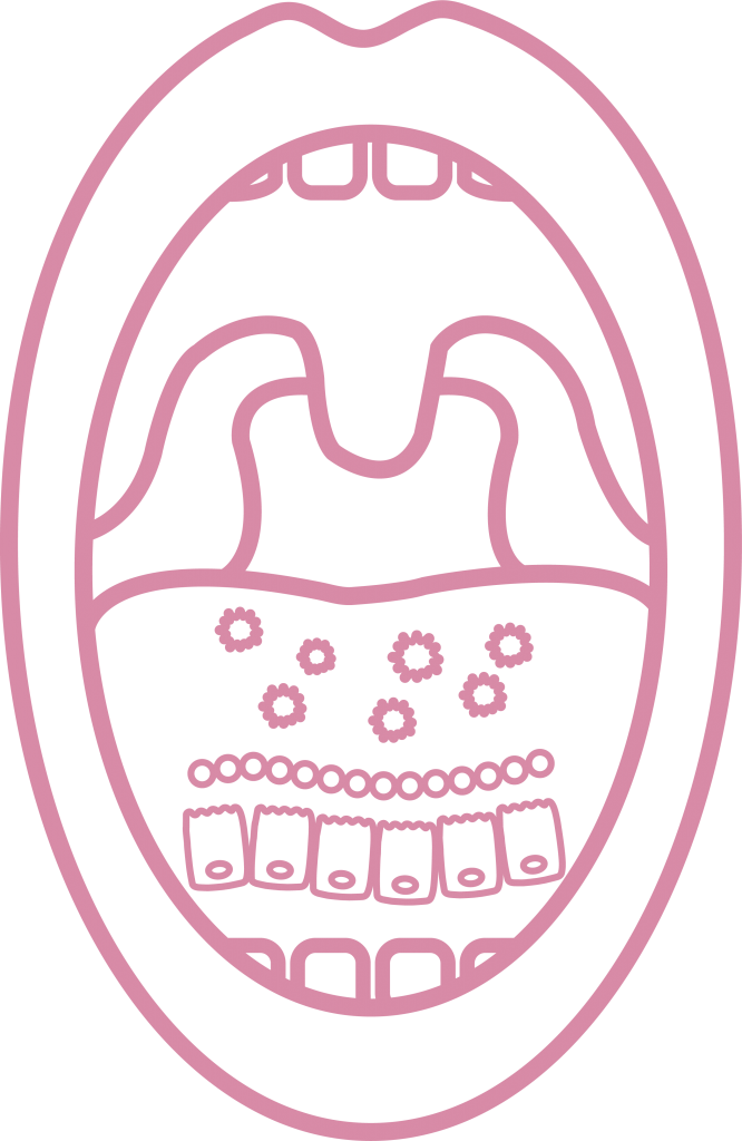 Secretory IgA IBS - Med Case Studies