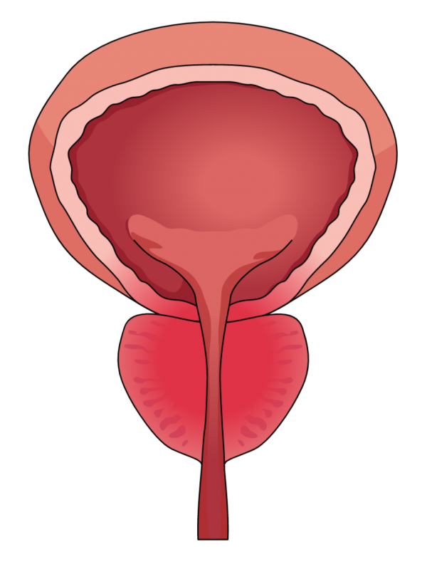 IBS symptoms in men: The male irritable bowel syndrome
