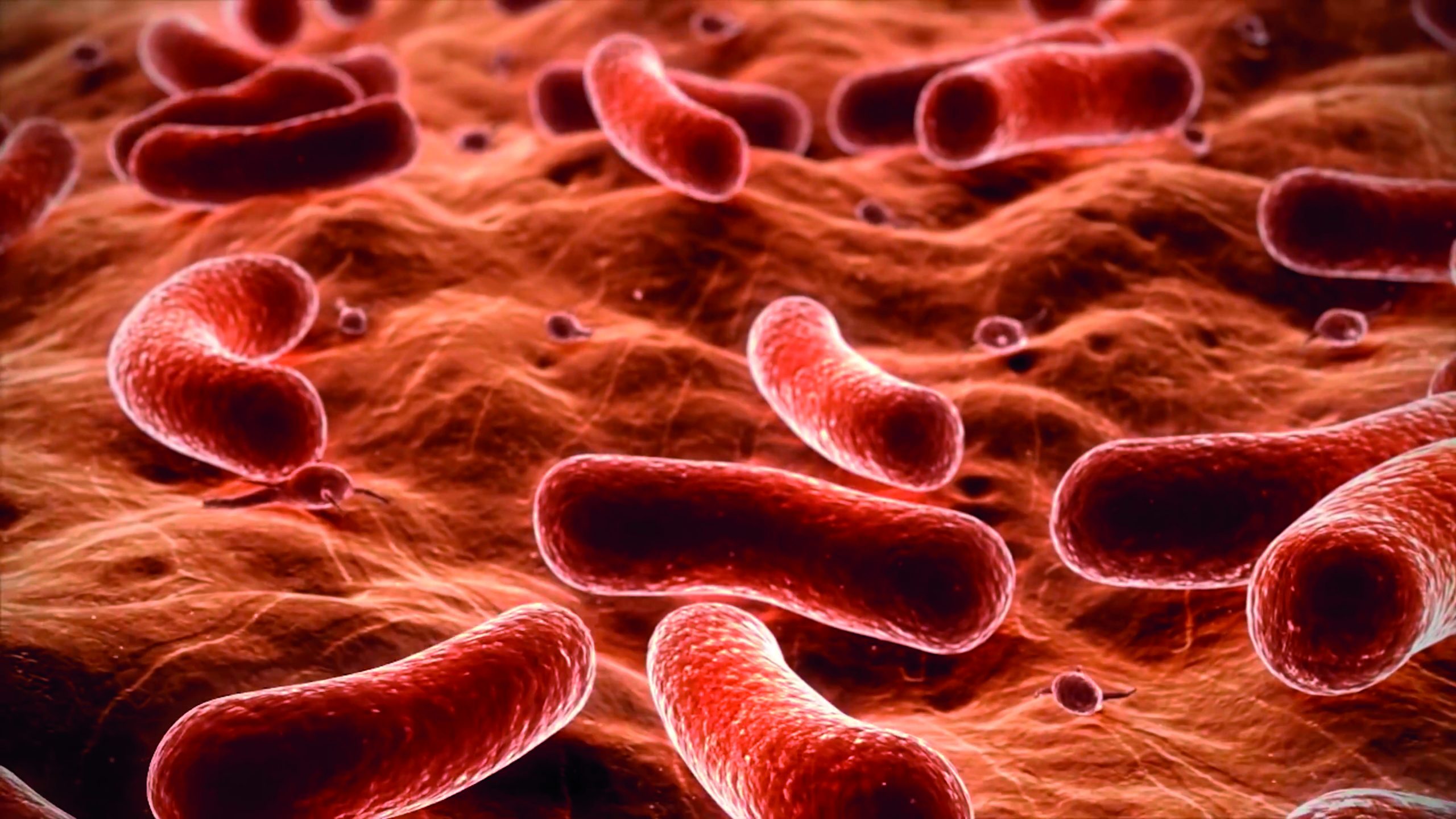Pseudomonas-predominant IBS - Med Case Studies