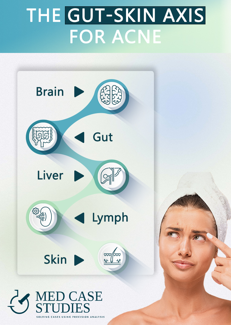 Acne treatment starts with gut health: The Gut-Skin Axis and the role ...